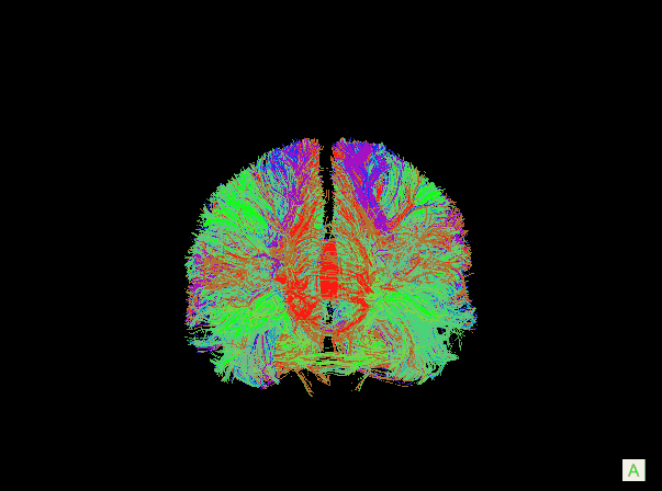 [Advanced Models in COnnectomics ] – Research Lab on Network Neuroscience